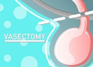 Let’s Talk About The “V” Word—Vasectomy | Urology Partners