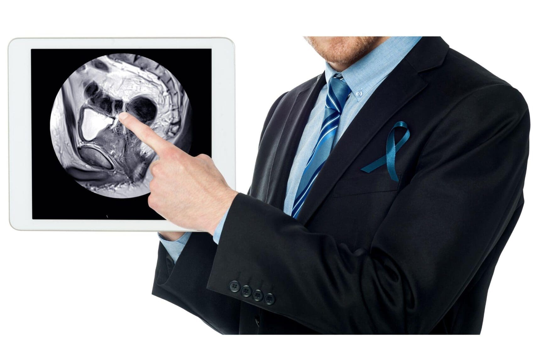 Advanced Prostate MRI For Cancer Detection In DFW | UPNT