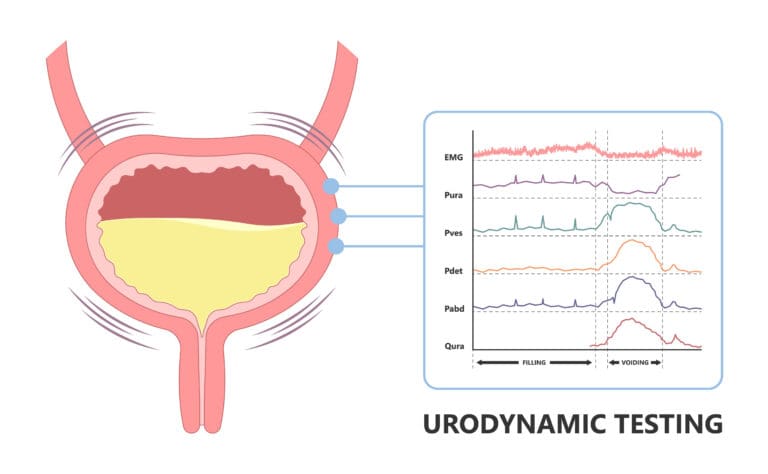 Urodynamics Testing For Bladder Function | North Texas | UPNT