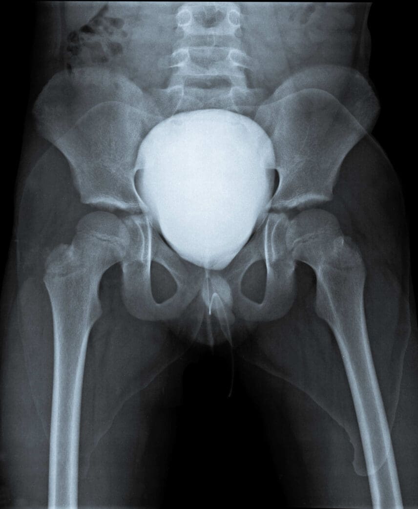 Urodynamics Testing For Bladder Function | North Texas | UPNT