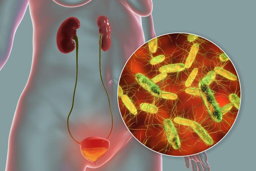 UTI Treatment For Women | Expert Female Care At UPNT