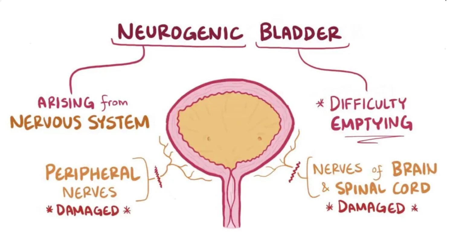 Neurogenic Bladder Management & Care | North Texas | UPNT