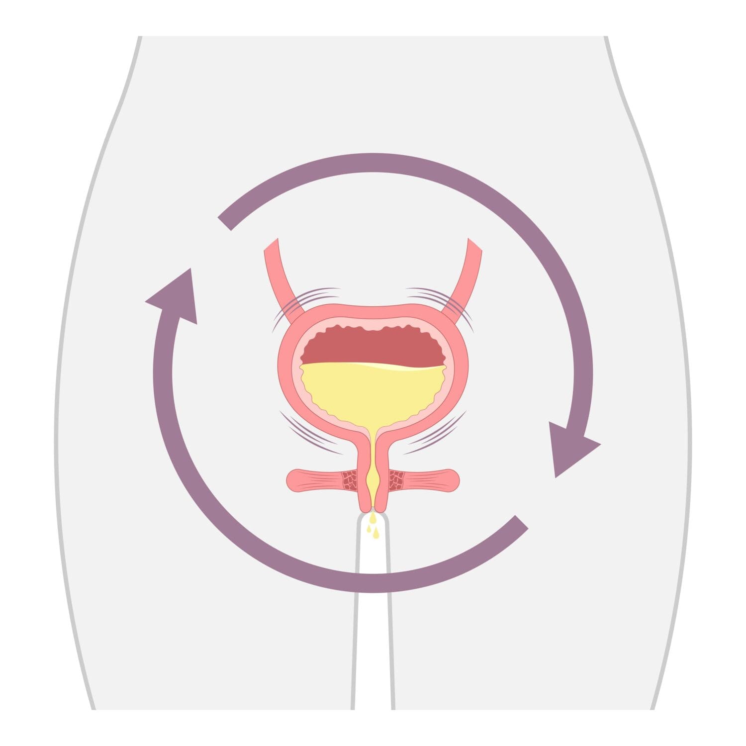 Women's OAB & Urge Incontinence Treatment | Dallas | UPNT